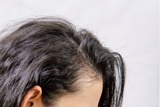 Skin Treatment – Skinray Skin & Hair Clinic